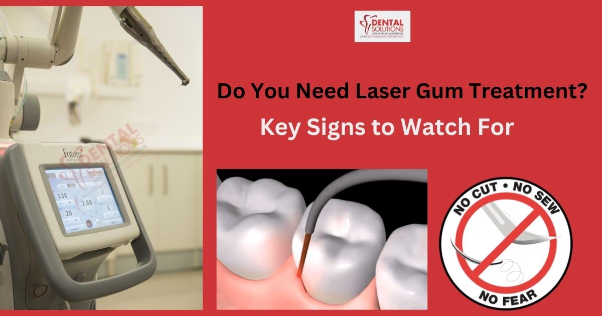Key Signs You Need Laser Gum Treatment
